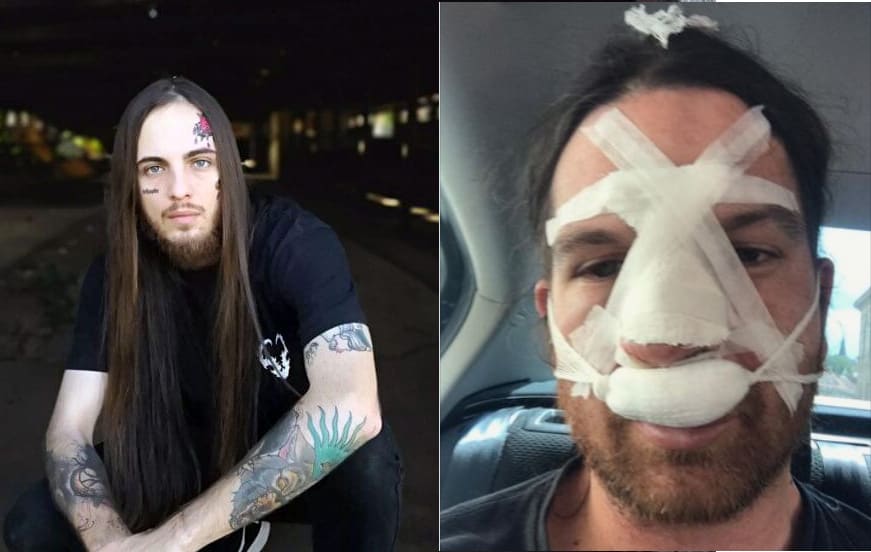 VULVODYNIA “singer Duncan Bentley removed due to serious incident of ...